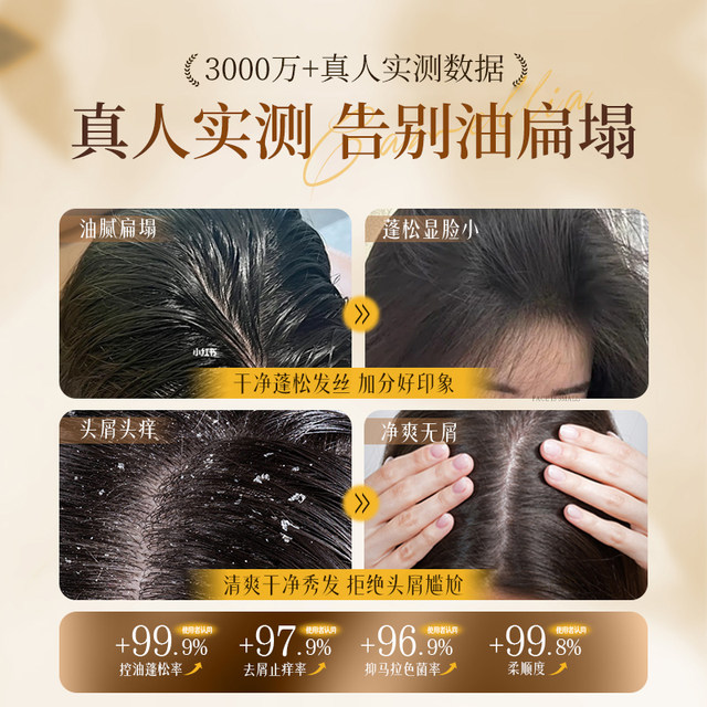 Shampoo oil control fluffy anti-dandruff anti-itch men and women shower gel set ointment ...