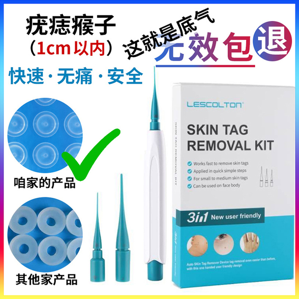 Wart Removal Artifact - Removes Filiform Warts, Sarcomas, And More ...