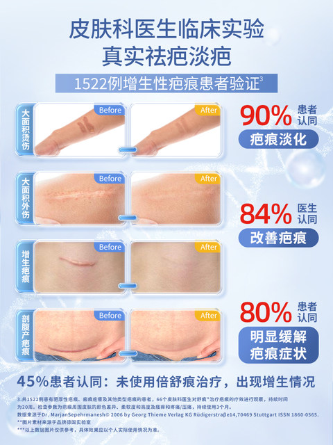 Dermatix Scar Cream 15g silicone gel post-operative caesarean section ...