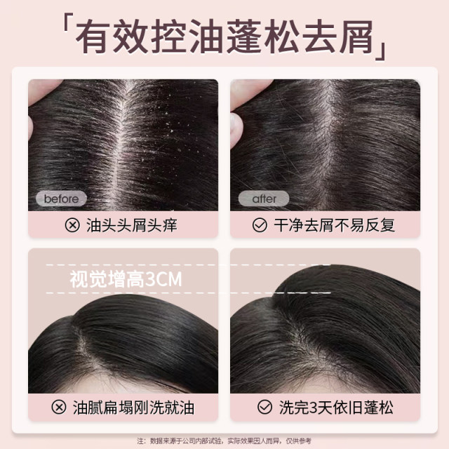 Shampoo oil control fluffy anti-dandruff anti-itch official authentic brand shampoo cream shower ...