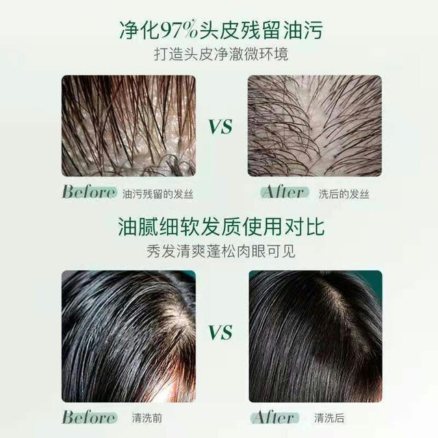 Genuine American Nizoral Renshan Lishu anti-dandruff anti-itch oil control shampoo without ...