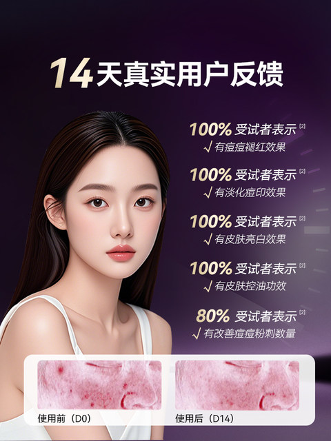 Yd High-Frequency Acne Removal Device, Electric Acne Scar Lightening ...