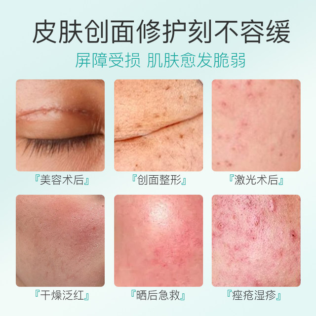 Fu Yuqing Medical Collagen Repair Cream Sensitive Muscle Dry Red ...