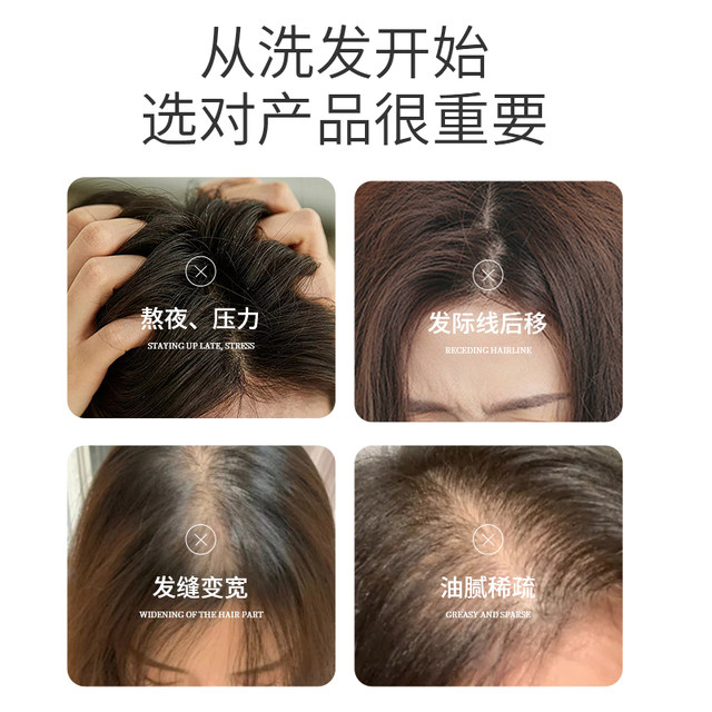 Turkish bioxcin pico raw garlic refreshing oil control shampoo shampoo ...