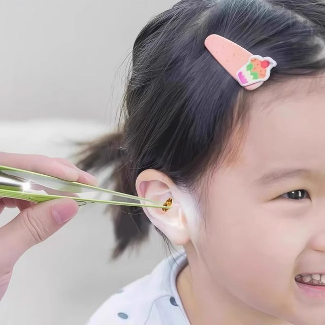 Luminous Ear Scoop Ear Tweezers Kidsren's Ear Picking Artifact Baby Ear ...