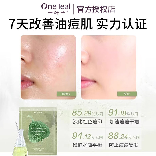 One-leaf facial mask removes acne, fades acne marks, closes pores, and ...