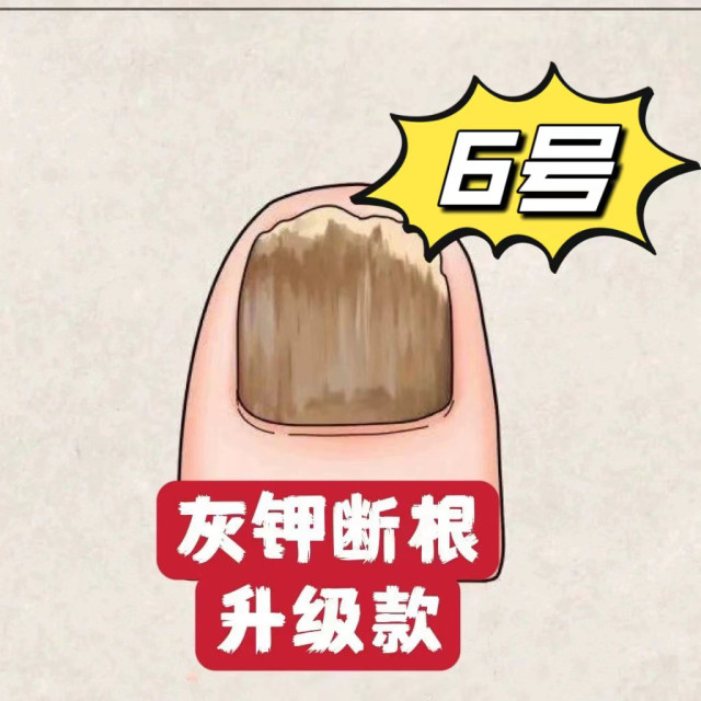 Gray armor upgraded version 4 free of charge, no shedding, thick armor ...