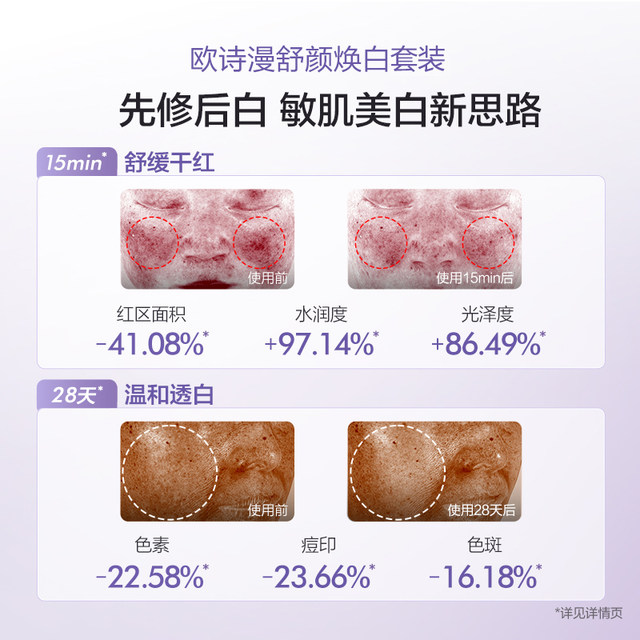 Oshiman Pearl Enzyme Safe Water Lotion Set Hydrates, Repairs Sensitive ...