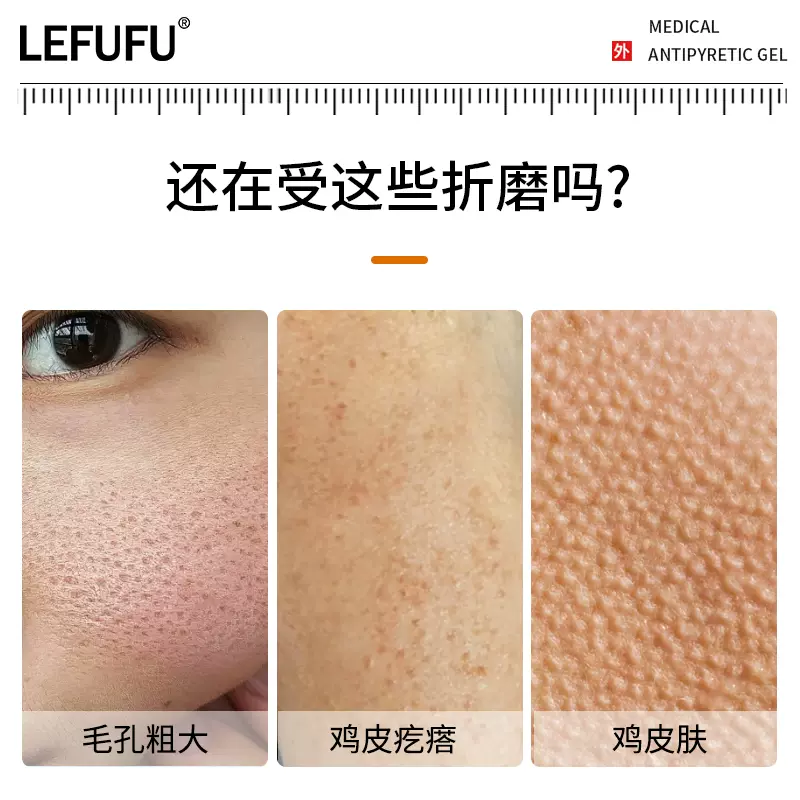 LEFUFU护理膏毛孔粗大医用鸡皮肤鱼鳞皮凝胶鸡皮疙瘩乐芙芙护理膏-淘宝网