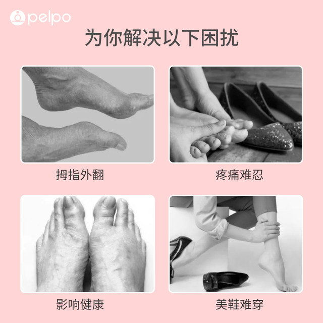 Foot arch trainer thumb valgus toe leg beautiful leg sharp tool foot ...