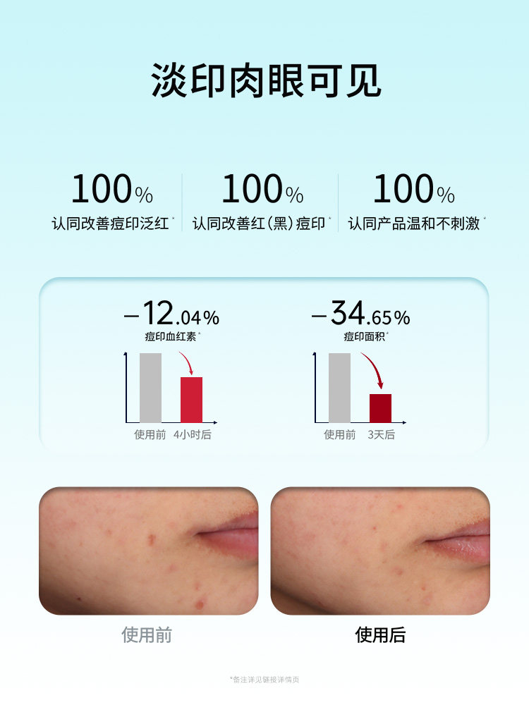 Jovs Electronic Acne Patch - LED Light Therapy for Acne & Marks