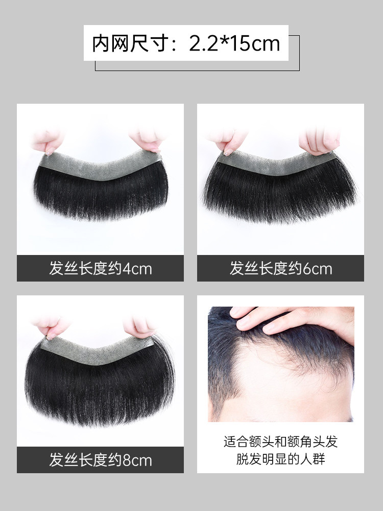 Renus Real Hairline Stickers for Men - Natural Forehead Thinning Coverage