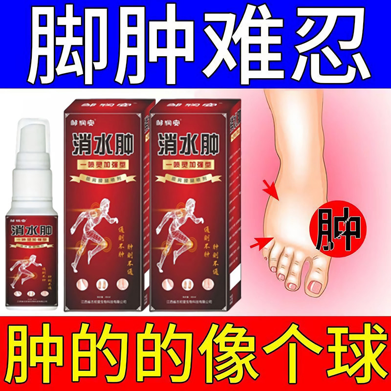 Zou Runan Edema Relief Spray for Legs & Feet - Swelling Reduction