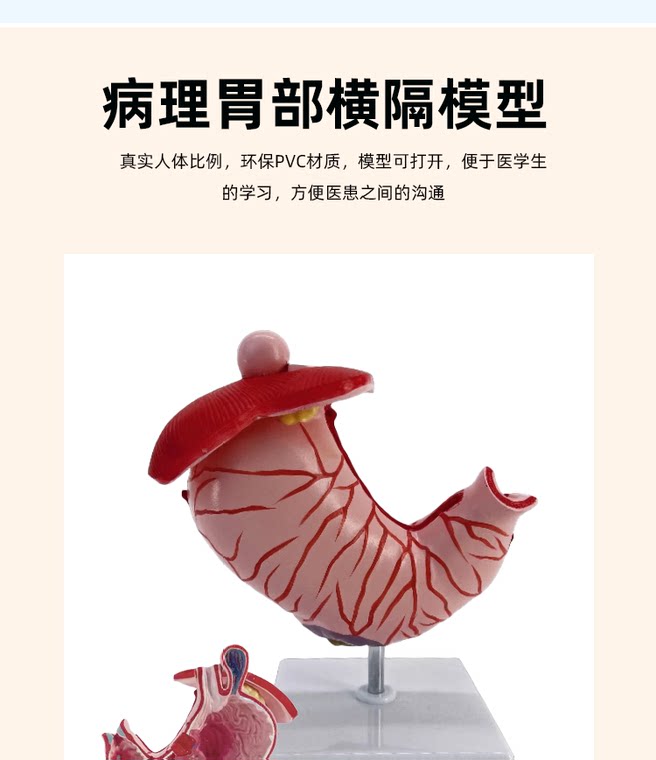 Human intestinal and gastric coronal structure anatomical model ...