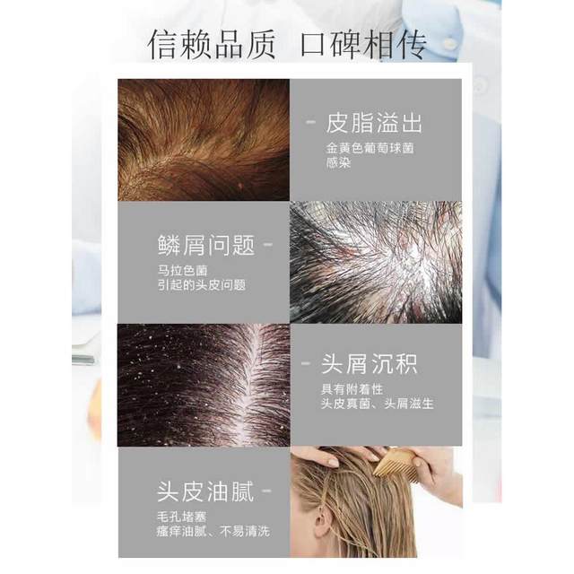 Rinshan Lishu hair follicle shampoo, dew -ded itching, anti -itching ...