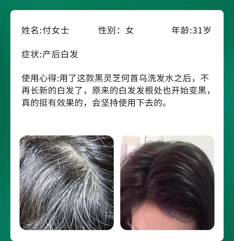 Herbal black mulberry and ginseng hair root shampoo shampoo lotion ...