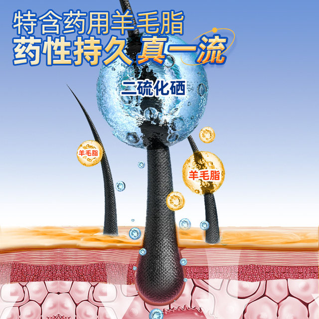 Medical official flagship store selenium disulfide lotion anti-dandruff ...