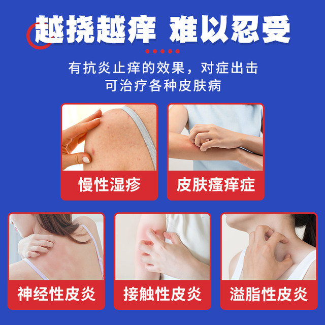 Compound dexamethasone acetate cream to remove skin eczema and relieve ...