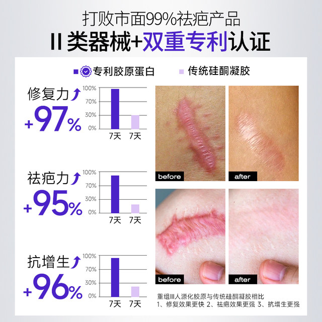 German scar removal cream to remove scars, repair burns, scar removal ...