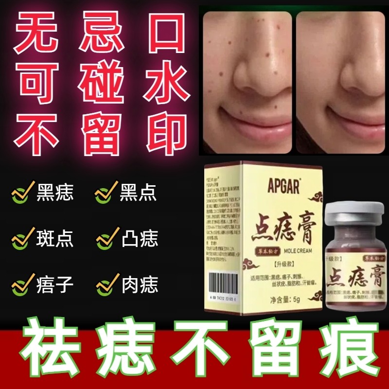 Apgar Dot Mole Cream - Scarless Mole & Freckle Removal