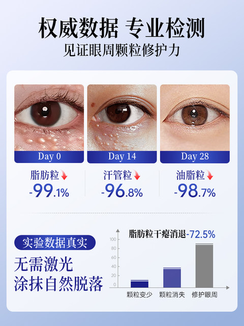 Renhe fat particles eye oil particles corners eye eye cream essence ...
