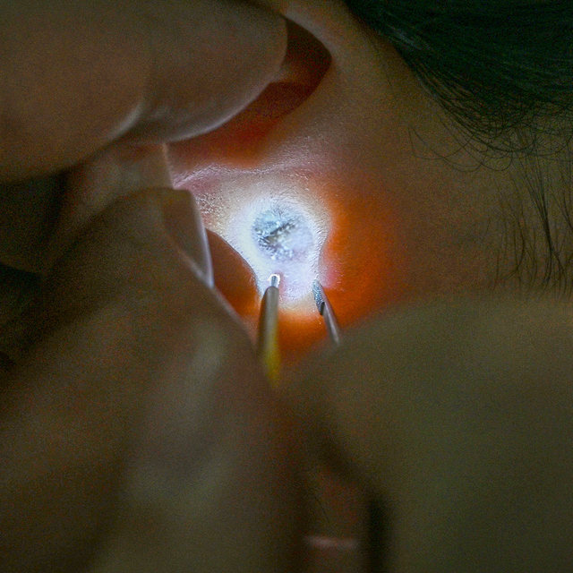 Glowing earwax tweezers, children's ear picks, silicone earwax hooks ...