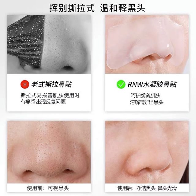 RNW nasal sticker removes blackhead acne closed mouth out export liquid ...
